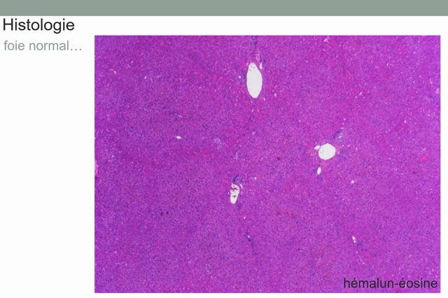 - Module G1a Td Anapath Inflammation